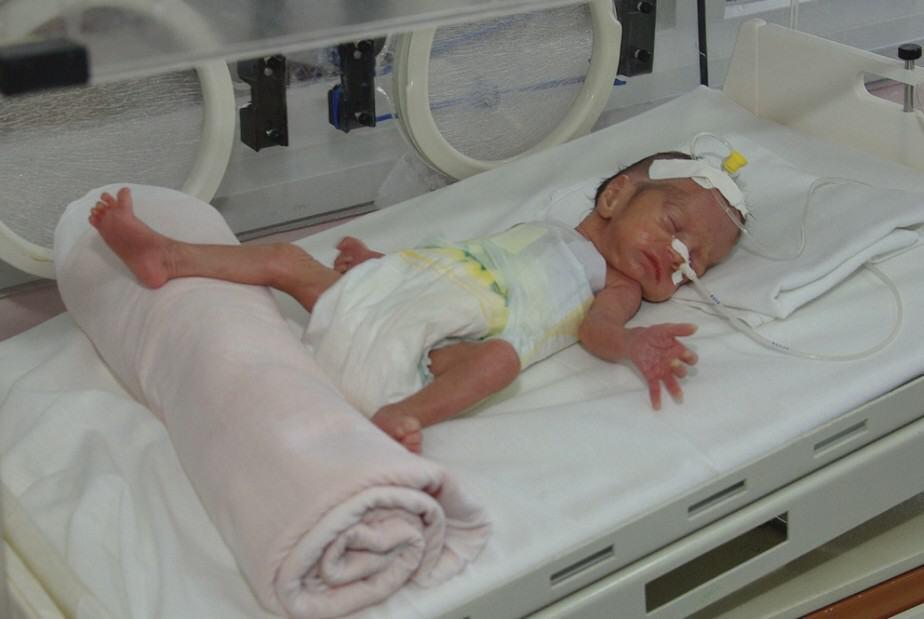 Understanding Necrotizing Enterocolitis NEC Guide For Parents Understanding Necrotizing Enterocolitis NEC Guide For Parents